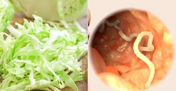 Tapeworm in cabbage Beaware doctors found 100 tapeworm eggs in girls ...