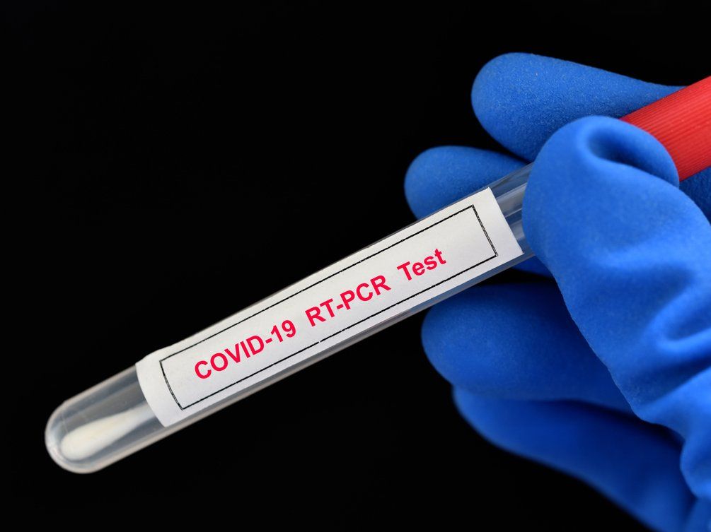 How to check RT PCR test report result online | Tech News