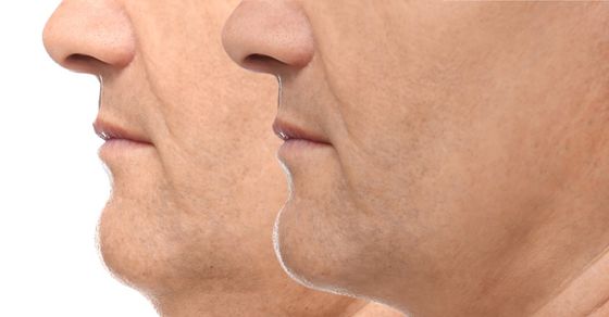 Double Chin: The face is deteriorating due to double chin then do this ...