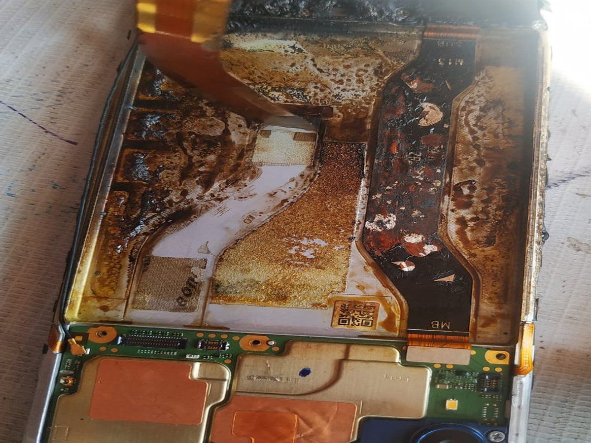 Jaipur Mobile Battery Blast: Childs hand damaged in mobile battery ...