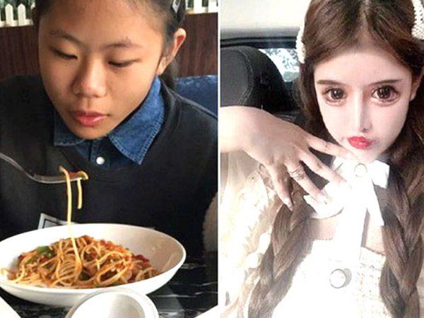 China 100 plastic surgeries to become beautiful 16-year-old girl Zhou ...