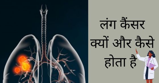 Sanjay Dutt Lung cancer reason | Sanjay Dutt cancer what is lung cancer ...