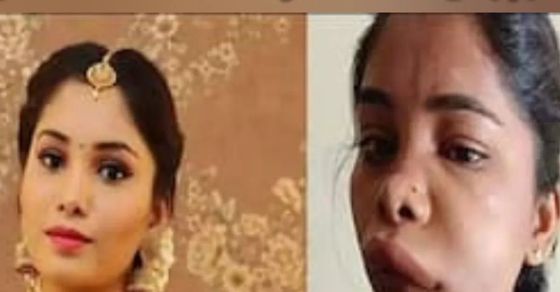 Kannada actress face swollen after root canal Surgery: Swathi Sathish ...